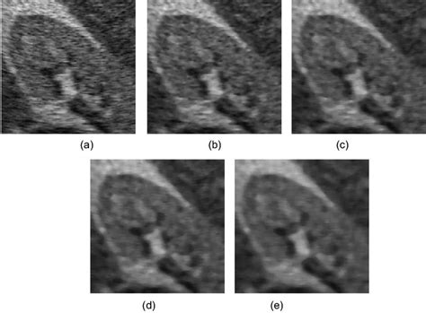 images after applying the median filter with different window sizes
