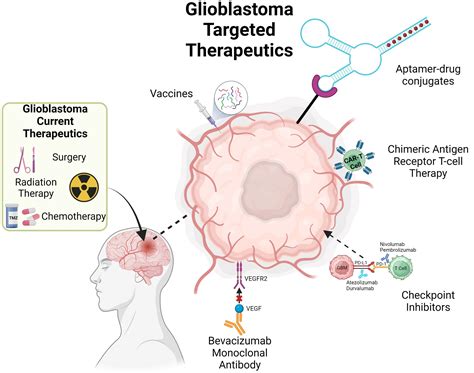 New Glioblastoma Clue May Enable Therapies To Weaken Tumors And