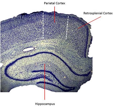 Researchers Id ‘conjunction Junction For Brains Navigation Function