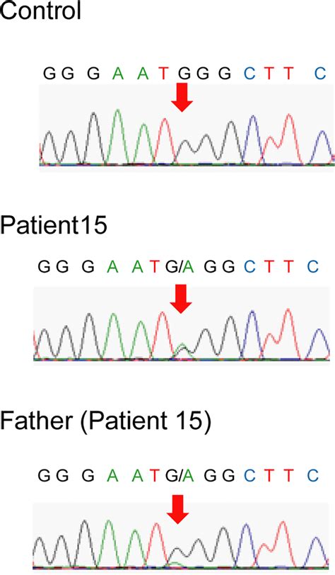 Sequence Electropherograms Of Patient 15 Sequence Electropherogram Of Download Scientific