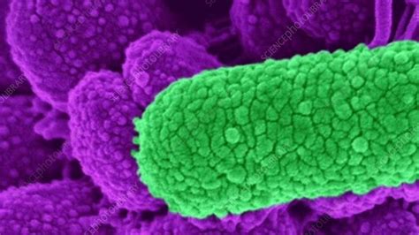 Oral Bacteria Sem Stock Video Clip K005 6854 Science Photo Library