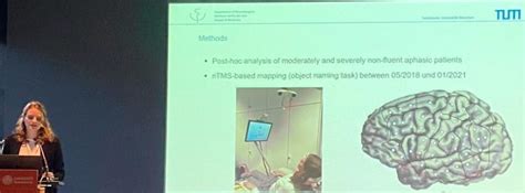 Nexstim On Linkedin Eans2023 Ntms Neurosurgery Brainmapping Languagemapping Aphasia