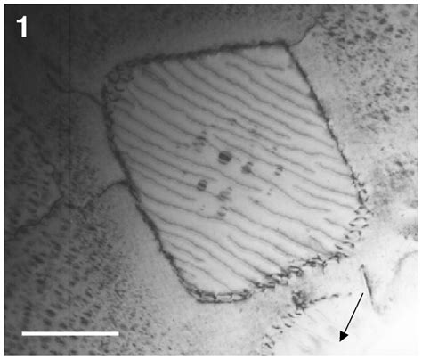 Bright Field Tem Micrograph Showing The Dislocation Distribution In A