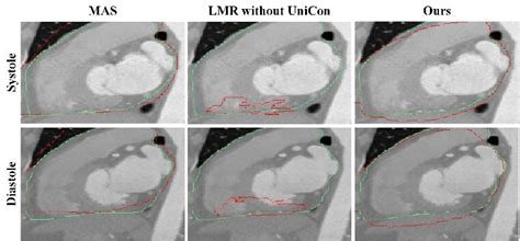 The Initial Segmentation Results Of Different Methods With The Same