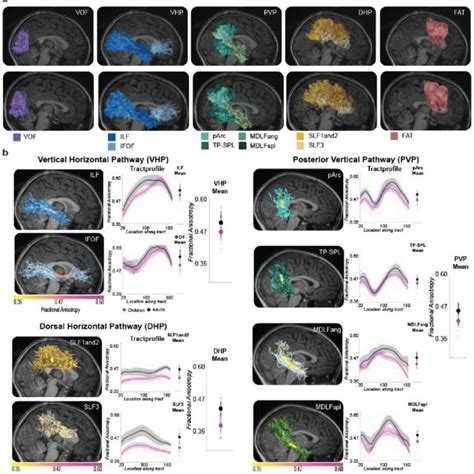White Matter Pathway Definitions And White Matter Microstructure Download Scientific Diagram