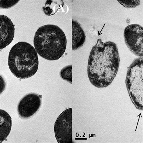 Transmission Electron Micrograph Of S Intermedius A Untreated