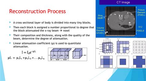 Physics Of Multidetector Ct Scan Ppt