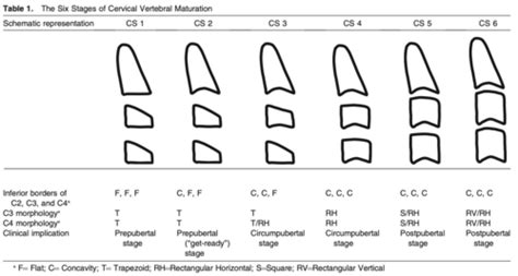 83 The Cervical Vertebral Maturation Method A Users Guide Flashcards Quizlet