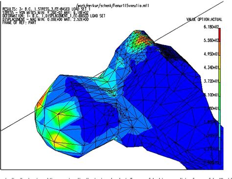 Figure 2 From Finite Element Model Of The Proximal Femur Under