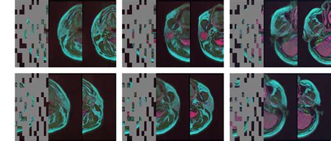 Figure 1 From Swin Mae Masked Autoencoders For Small Datasets Semantic Scholar
