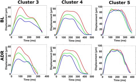 Averaged Waveforms Of Clusters 3 4 And 5 From The Focal Groups In