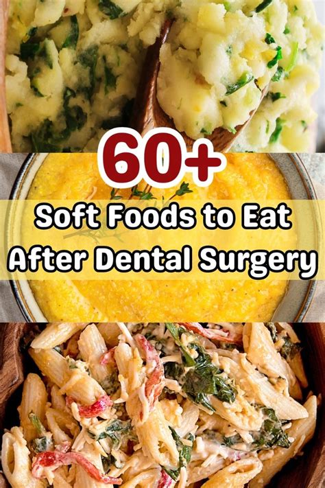 60 Soft Foods To Eat After Dental Surgery Soft Foods To Eat Soft Foods Diet Soft Foods