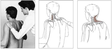 Scapular Elevation Mmt Thử Cơ Nâng Bả Vai Y HỌc PhỤc HỒi