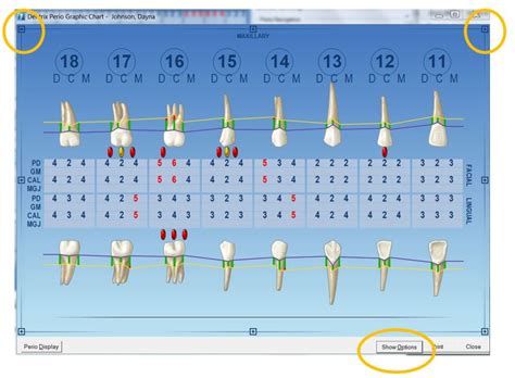 Perio Surgery Dental Codes At Leigh Clanton Blog