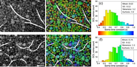 Suite Of Methods For Assessing Inner Retinal Temporal Dynamics Across