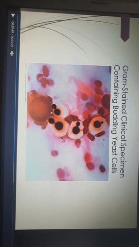 Lecture On 19 10 2023 Enumeration Of Yeasts And Moulds Flashcards Quizlet