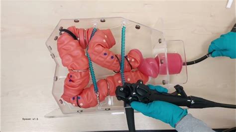 Magnetic Flexible Endoscope A Novel Platform For Diagnostic And