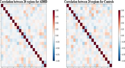 Figure From DNN Based Classification Of ADHD FMRI Data Using Functional Connectivity