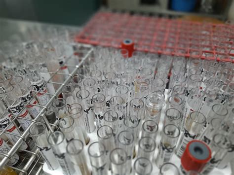 Serological Tests Introduction Some Common Serological Test