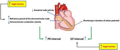 Electrophysiological And Electrocardiographic Effects Of Digoxin A Download Scientific