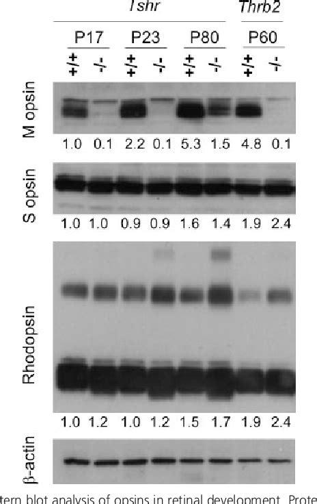 Figure 2 From Retarded Developmental Expression And Patterning Of