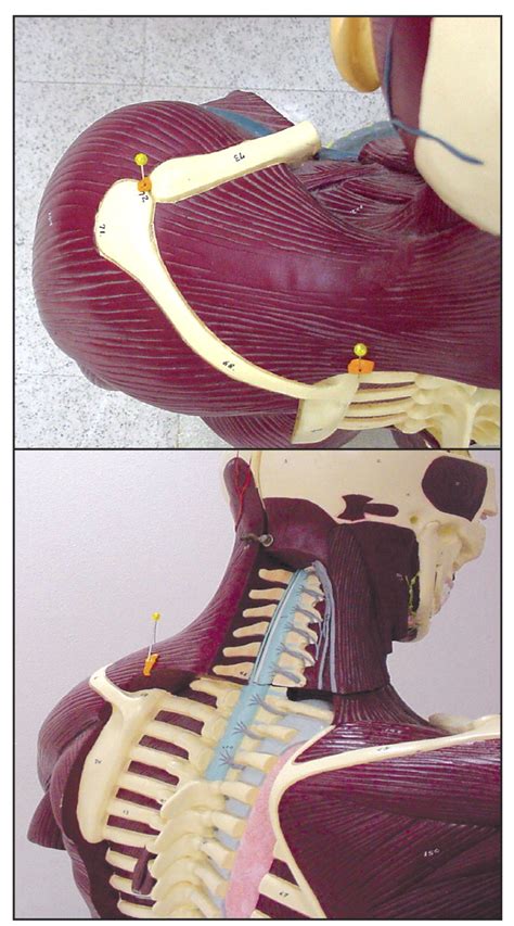 Landmarks For Lateral Scapula And Scapular Y Positioning 40 Off