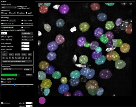 Cellpose Custom Model Performance Suffers In 3d Usage And Issues