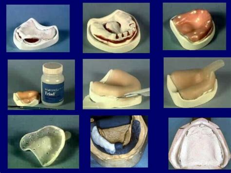 Ii Impression Making For Complete Denture Ppt Dental Health Diseases And Conditions