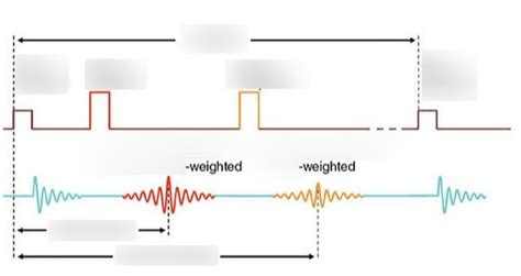 Dual Spin Echo Diagram Quizlet