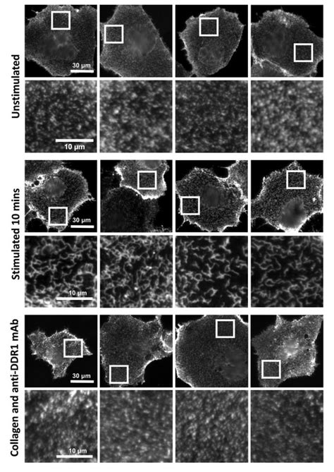 Collagen Induces Activation Of Ddr1 Through Lateral Dimer Association