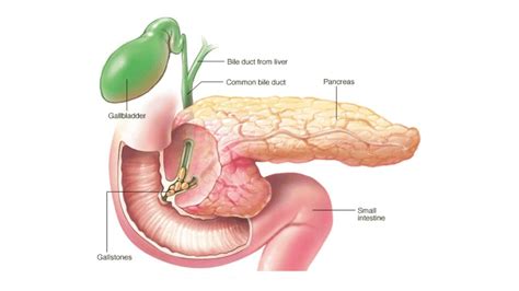 Ercp Procedure Gallbladder And Pancreas Exam Explained