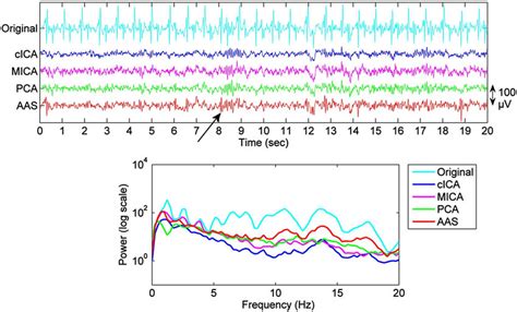 Time Course Top And Power Spectrum Bottom Of Eeg Recording Download Scientific Diagram