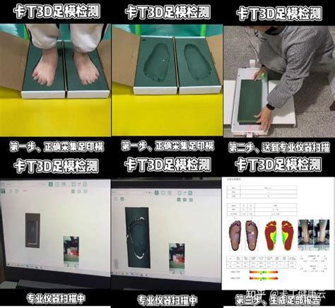 60 的儿童青少年存在足部健康问题！家长必须重视起来了！ 知乎