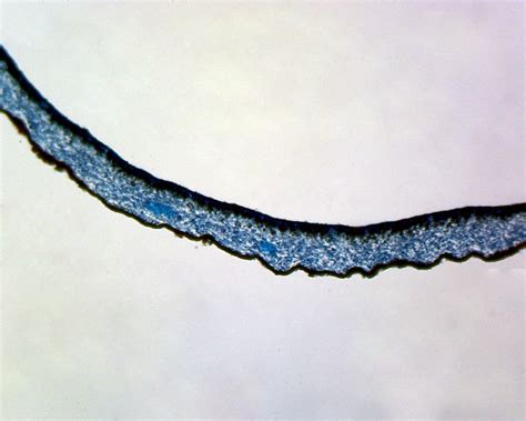 Lichen Microscope Slide