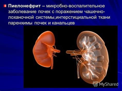 Презентация на тему: "Пиелонефрит у детей. Этиология, патогенез ...