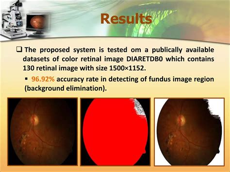 Automatic Detection Of Diabetic Maculopathy From Fundus Images Using Image Analysis Techniques Ppt