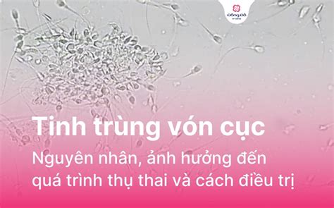 Tinh Trùng Vón Cục Là Gì Nguyên Nhân Và Dấu Hiệu Bất Thường Trung
