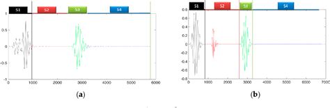 Figure 1 From Classification Of Heart Sound Signal Using Multiple Features Semantic Scholar
