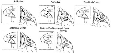 Pdf Limbic Connections Of The Orbital And Medial Prefrontal Cortex In