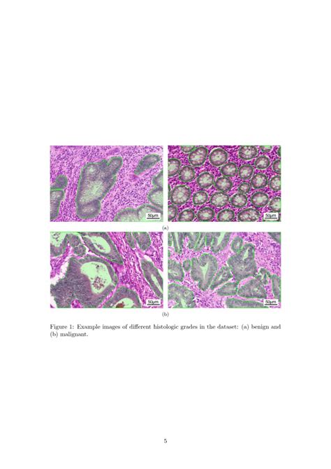 gland segmentation in colon histology images the glas challenge