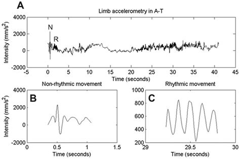 Accelerometry From One A T Subject During Postural Condition Composite Download Scientific