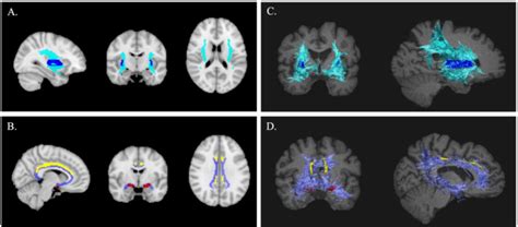 The Templates For The Lateral A And Medial B Tracts In Mni Space