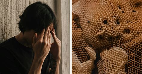 Understanding Trypophobia The Reason Your Brain Responds To Small Holes Total News