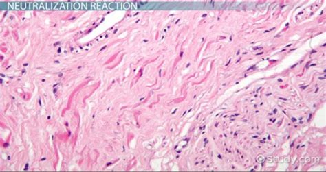 Nervous Tissue Function Types Parts Lesson Study