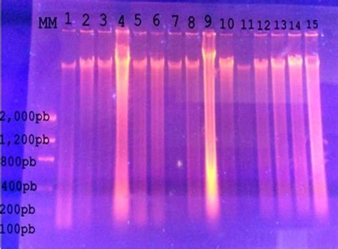The Total Genomic Dna Isolated From Solanum Betaceum Cav Using