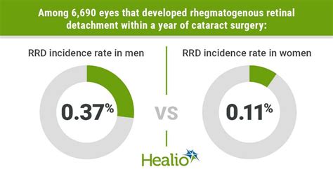 Age Sex Influence Risk For Retinal Detachment After Cataract Surgery
