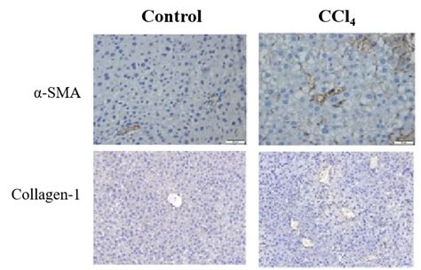 小鼠肝纤维化模型 哔哩哔哩