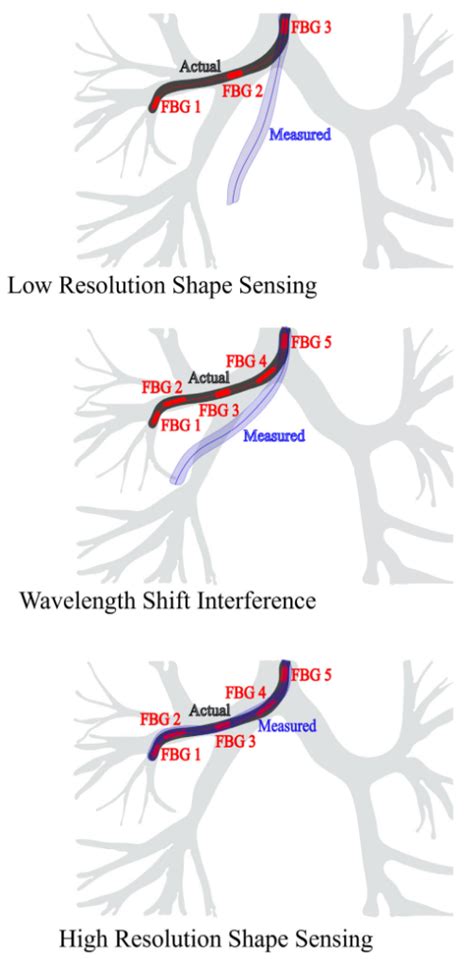 Research Surgical And Interventional Robotics Group
