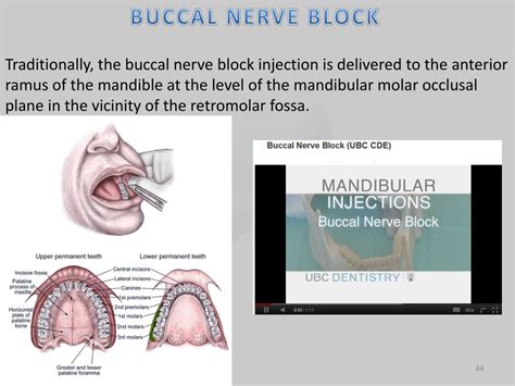 PPT TRIGEMINAL NERVE PowerPoint Presentation Free Download ID
