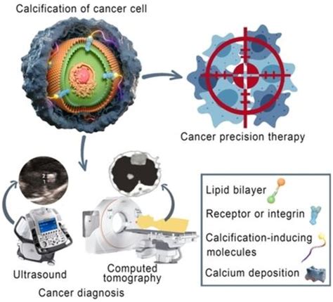 Calcification Based Cancer Diagnosis And Therapychemmedchem X Mol